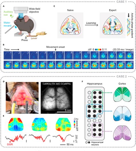 Figure 3 From Wide Field Calcium Imaging Of Cortex Wide Activity In Awake Head Fixed Mice
