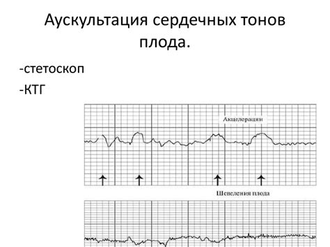 Акушерские исследования наружные внутреннее Диагностика беременности презентация онлайн