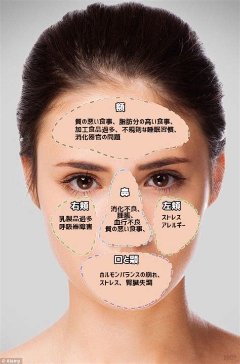 ニキビや吹き出物のできる位置でわかるあなたの健康状態とその解消法英研究 カラパイア Face mapping acne Face