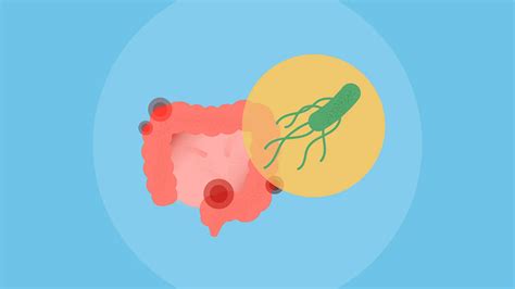 5 Foods Colon Cancer Docs Would Never Eat 5 Foods Colon Cancer Docs Would Never Eat