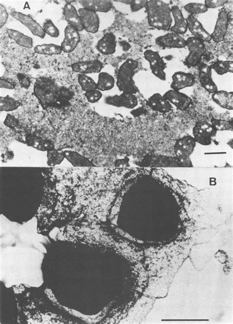 Electron Micrographs Of Thin Sections A And Negative Stain