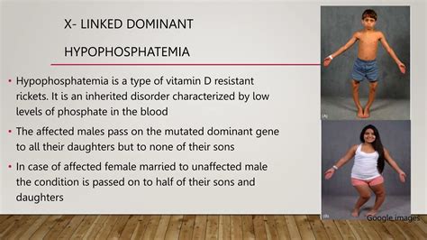 Basic Genetics Sex Determination Genetic Disorders Chromosomal