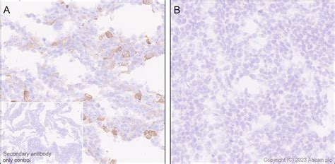 Anti Loricrin Antibody [epr28296 23] Ab315806 Abcam