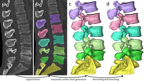 Creation Of Ct Based 3d Geometry A Ct Scan B Segmentation Masks Download Scientific