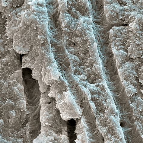 Dentine Tooth Tissue Sem Stock Image P4860141 Science Photo Library