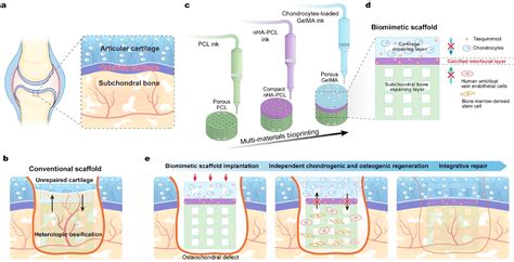 纳米人 Bioact Mater ：利用具有钙化界面层的 3d 打印仿生支架增强骨软骨再生