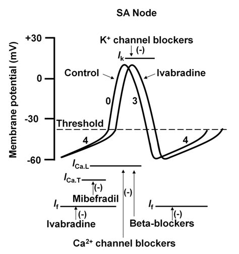 What Is A Pacemaker Heart Diagram