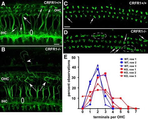 The Mouse Cochlea Expresses A Local Hypothalamic Pituitary Adrenal Equivalent Signaling System
