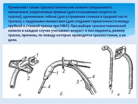 Трахеостомия. Показания к проведению трахеостомии - презентация онлайн
