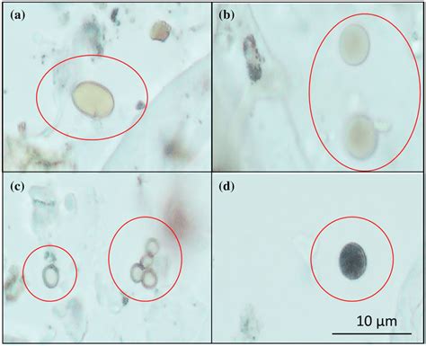 Mold Under Microscope