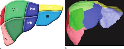 Hepatic Segmental Anatomy Diagram A And Corresponding Color Coded Download Scientific