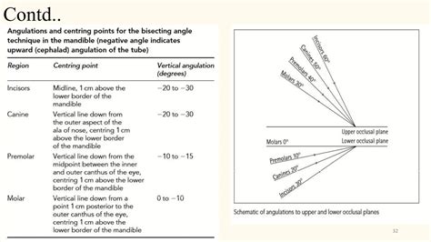 Technique Of Dental Radiographic Pptx