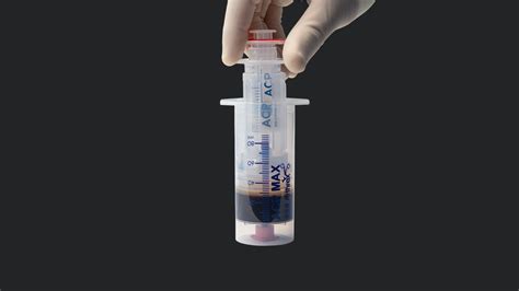 Arthrex Creating PRP With The ACP Max PRP System