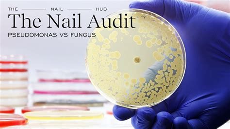 Pseudomonas Vs Fungus Season 1 The Nail Hub Tv