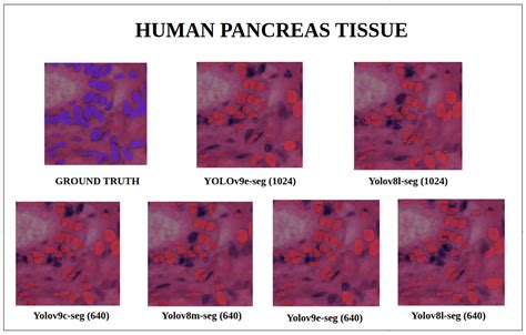YOLOv9 Instance Segmentation On Medical Dataset