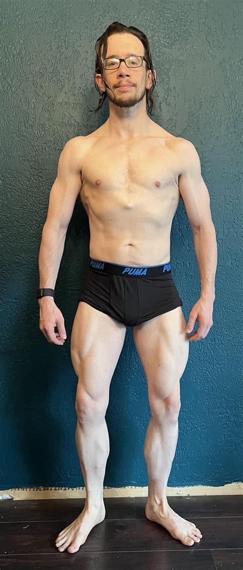 Xiphoid Process Protrusion