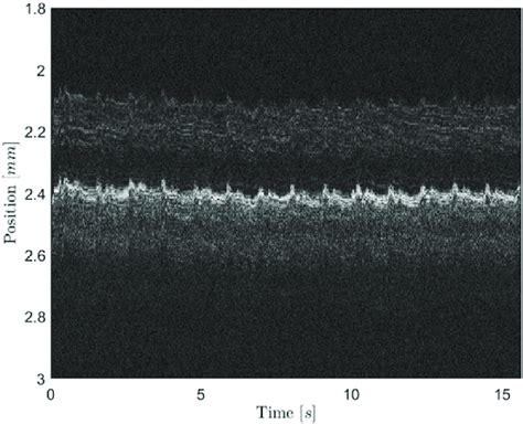 Image Showing Instrument Integrated OCT Based Sensor A Scan Recordings Download Scientific
