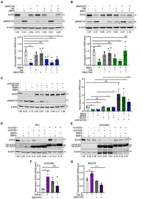 Sox2 Is Reciprocally Regulated By Alk2alk3 And Alk5 Receptor Kinases