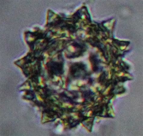 Unidentified Specimen Global Pollen Project Global Pollen Project