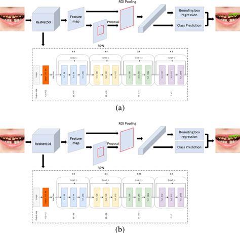 Figure 1 From Dental Caries Detection Using Faster Region Based