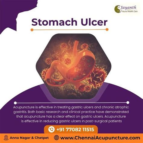 Chennaiacupuncture Acupuncturechennai Acupuncturetherapy