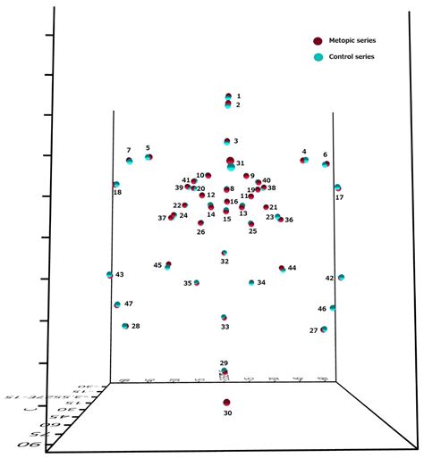 Endocranial Morphology In Metopism