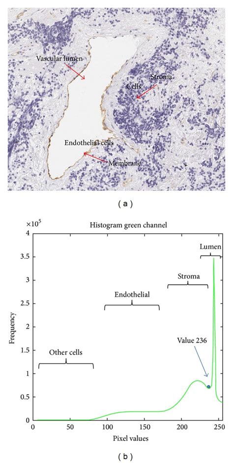 Statistical Analysis Of The TMA Structures Based On The Image Download Scientific Diagram
