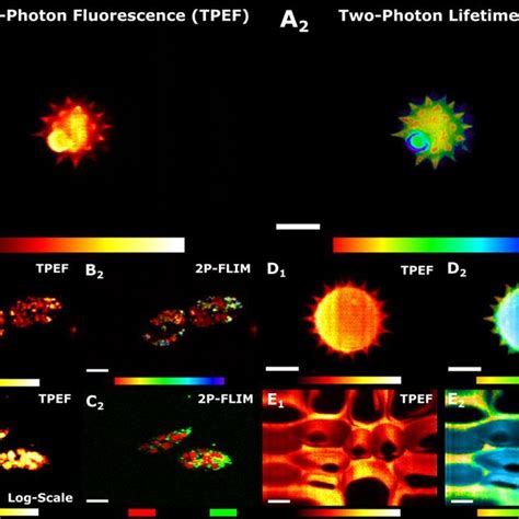 Two Photon Fluorescence Lifetime Imaging 2p Flim In High Speed