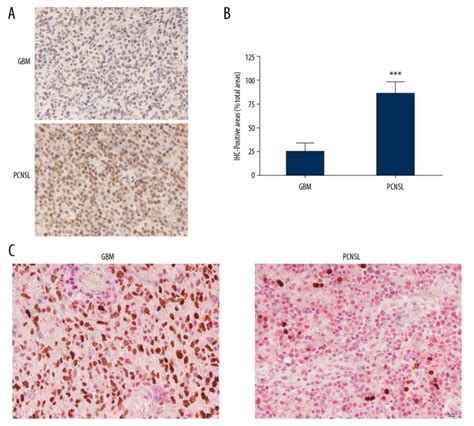 Expression And Function Of Toll Like Receptor 10 Tlr10 In Diffuse