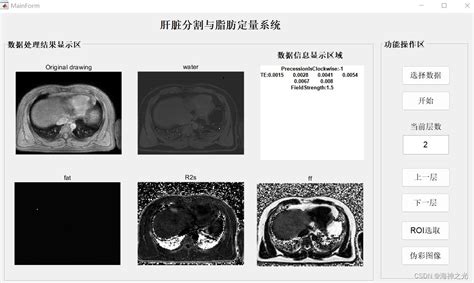 【肝脏分割】基于matlab gui计算机视觉肝脏分割和脂肪定量系统【含matlab源码 2528期】 怎么用matlab实现肝脏分割 csdn博客