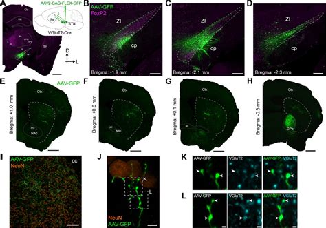 Subthalamic Nucleus