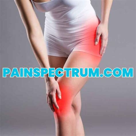 Can Sciatica Causes Knee Pain Best Guide 2024 Painspectrum