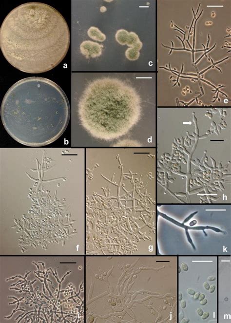 Trichoderma Neokoningii Ab Colonies On Pda A And Sna B After 1