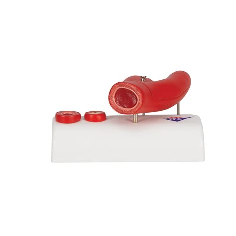 Arterioskleroza Fantom Pomoce Dydaktyczne Fantomy Szkoleniowe Modele Anatomiczne Szkielet I