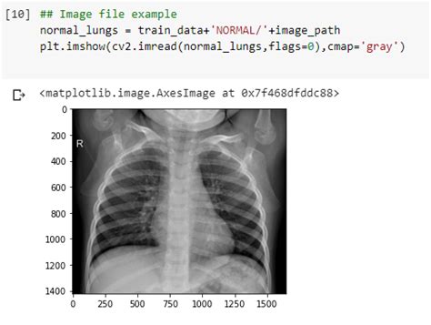 Artificial Neural Networks Part 5 — Implementing Cnn Using Tensorflow And Keras By Saket
