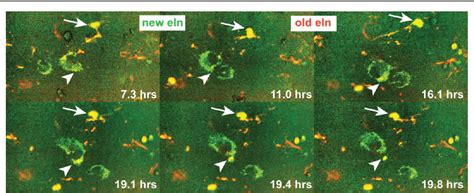 Elastic Fibers Semantic Scholar
