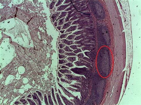Placas De Peyer Características Funciones Histología