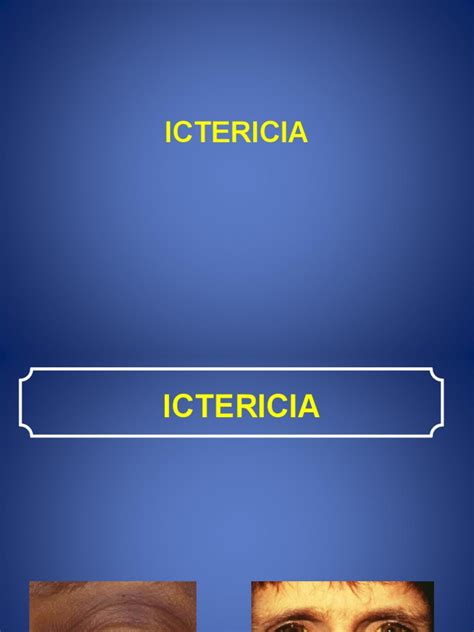 Ictericia Pdf Cirrosis Hepatitis