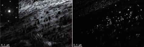 Tem Micrograph Showing A Lower Bainite In Carburized Layer Of Hc Sample Download Scientific
