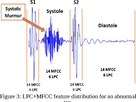 Figure 1 From Classification Of Heart Sounds Using Linear Prediction Coefficients And Mel