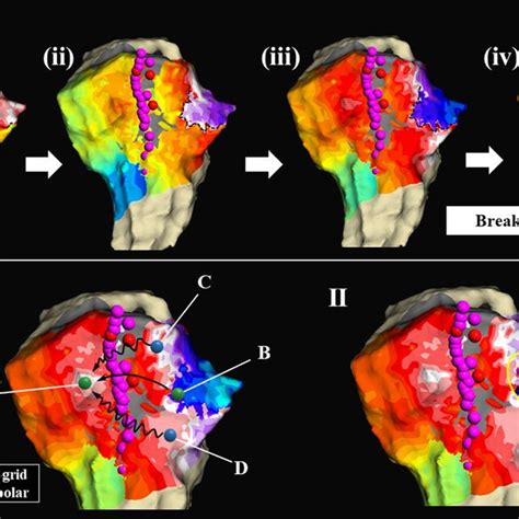 Activation And Voltage Maps During Afl After The Cti Linear Ablation Download Scientific