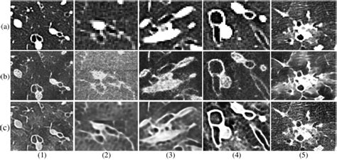 Row A Original Clinical Ct Images B Sr Result Of Conventional Download Scientific