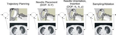 2 Four Steps In A Ct Guided Procedure Download Scientific Diagram