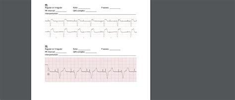 Solved 49 P Waves Regular Or Irregular PR Interval Chegg Com