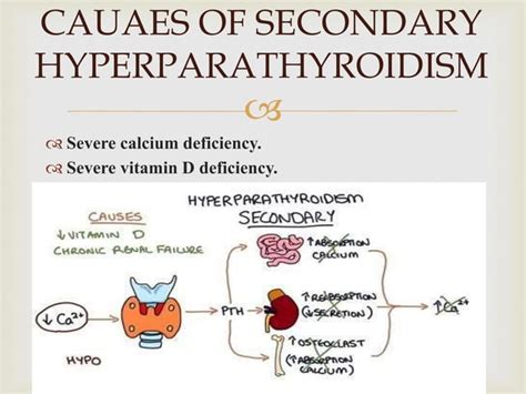 Hyperparathroidism And Hypopera Ppt Pptx