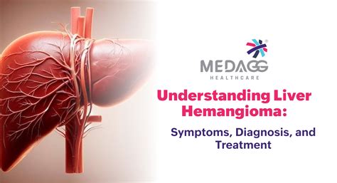 Liver Hemangioma Understanding Diagnosing And Treatment Options Medagg