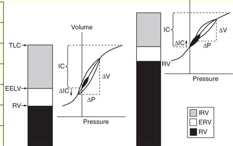 Static Lung Volumes And Adjacent Pressure Volume Plots Are Shown For A