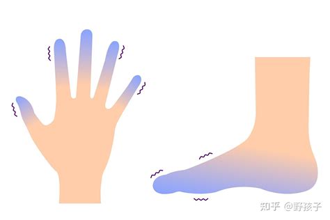 好用管用的冻疮膏及方法！ 知乎