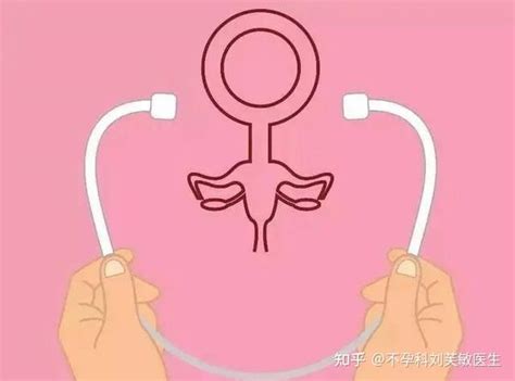 输卵管粘连，还能自然受孕吗？ 知乎