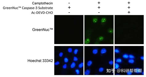 细胞分析检测串讲之二 细胞凋亡检测 知乎